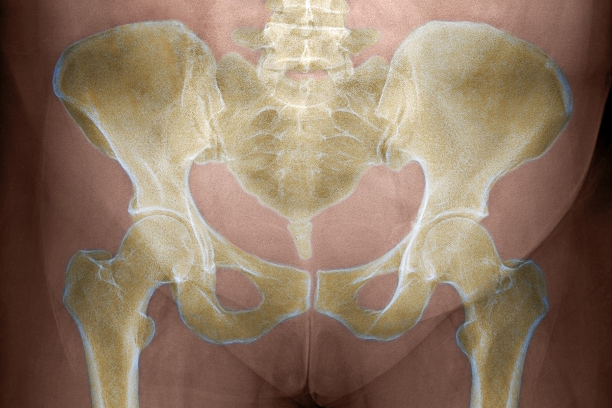 Discoveries in Medicine - Chronic Pelvic Pain: A Paradigm for Diagnosis ...