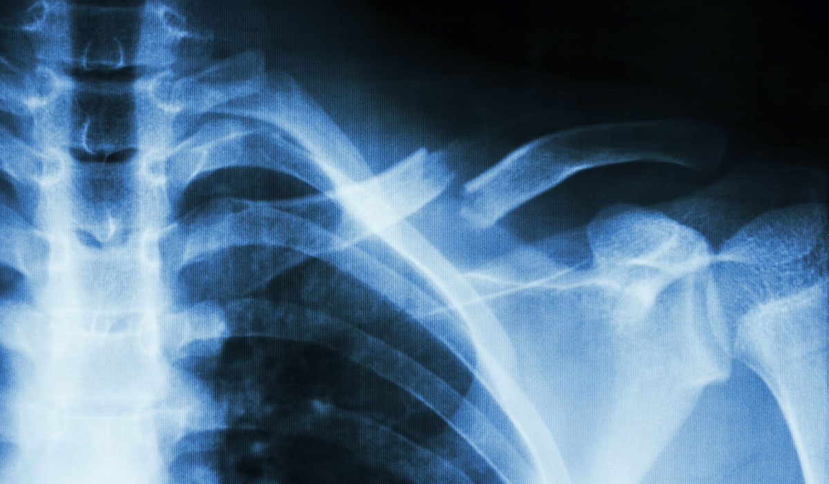 Discoveries in Medicine - Probing the Underlying Causes of Fragility ...