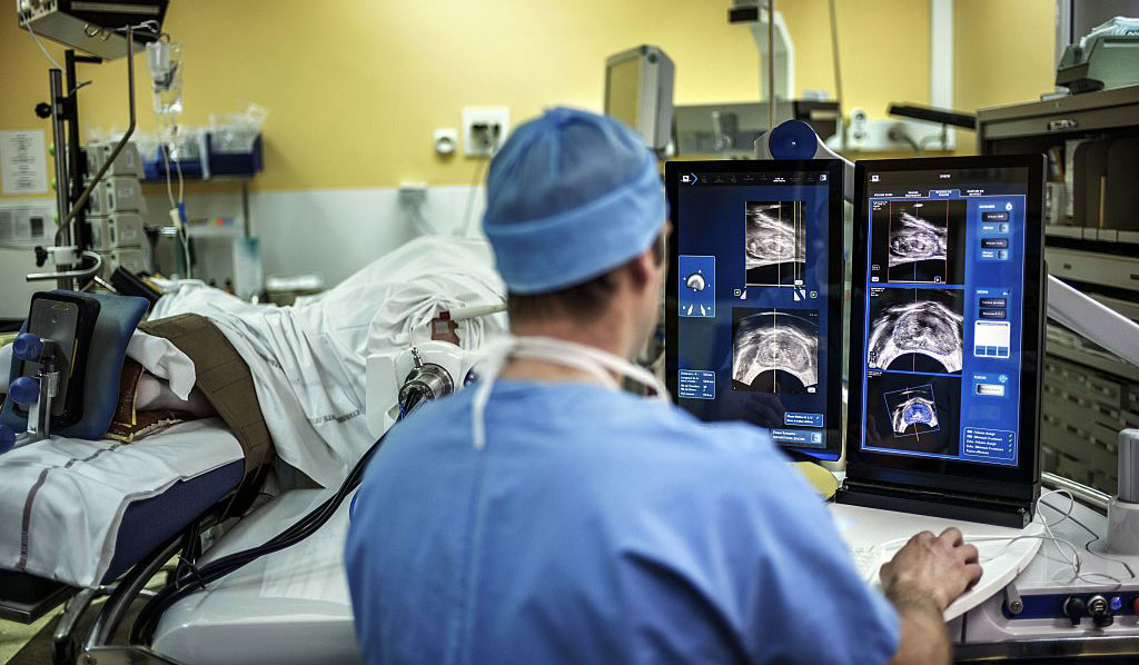 HIFU as Alternative Therapy for Prostate Cancer - Vanderbilt Discover