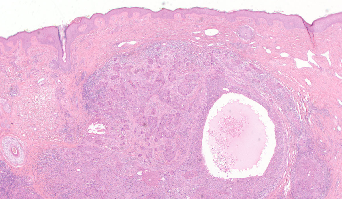 Discoveries in Medicine - Molecular Profiling Offers Clues to Treat ...