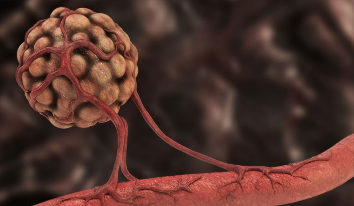 Discoveries in Medicine - Focusing on Vascular Effects of Cancer Therapies