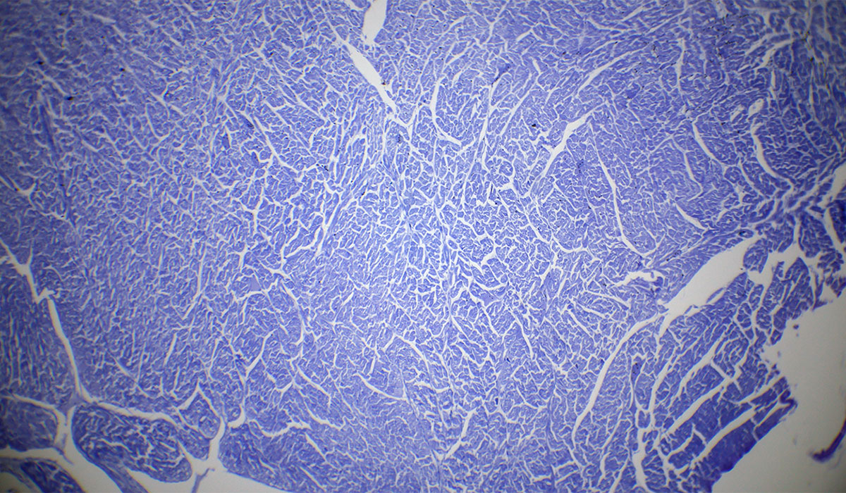 Discoveries in Medicine - Cell Reprogramming: From Fibroblast to ...