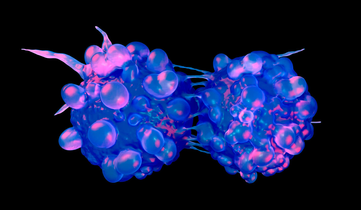 Discoveries in Medicine - Blue Light Cystoscopy for Outpatient ...