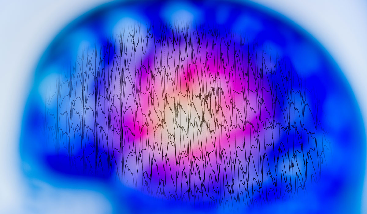 Discoveries in Medicine - Temporal Lobe Resection Improves Brain ...