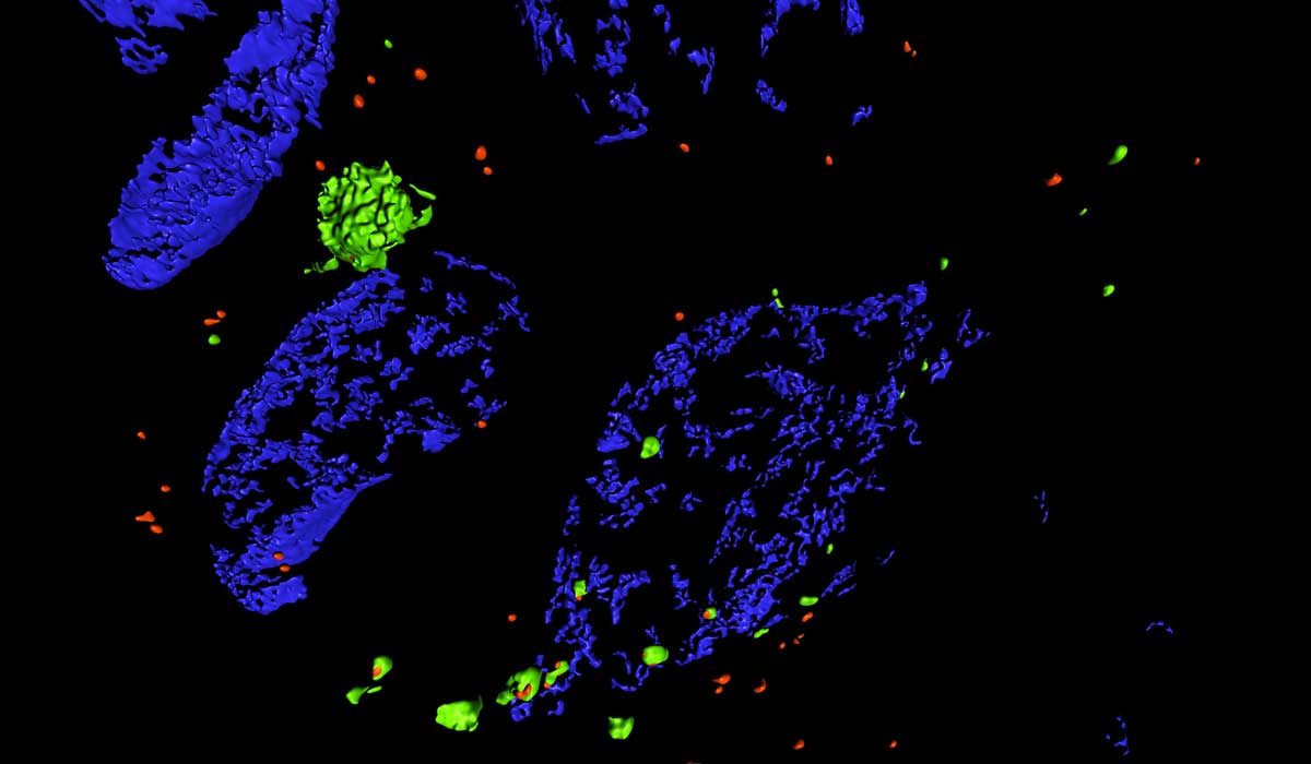 Utilizing super-resolution microscopy for cellular dynamics ...