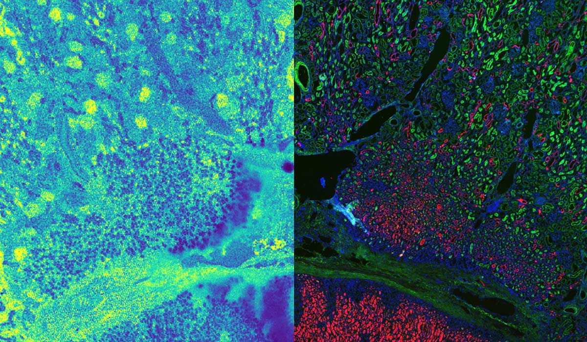 The Atlas Program: Building a 3D Molecular Guide - Vanderbilt Discover