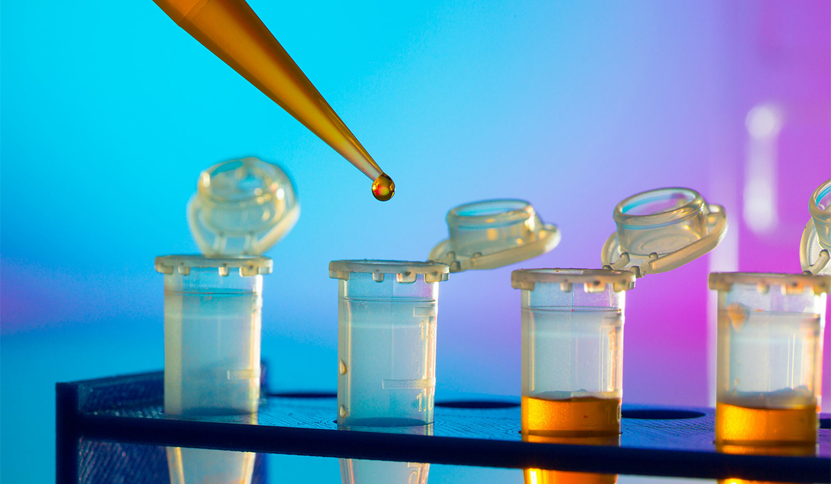 Proteinuria to Predict Acute Kidney Injury and Disease - Vanderbilt ...