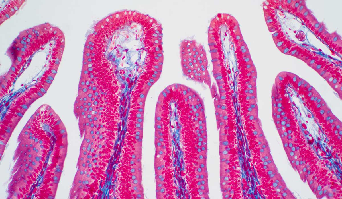 A Role for T Cells in NEC - Discoveries in Medicine