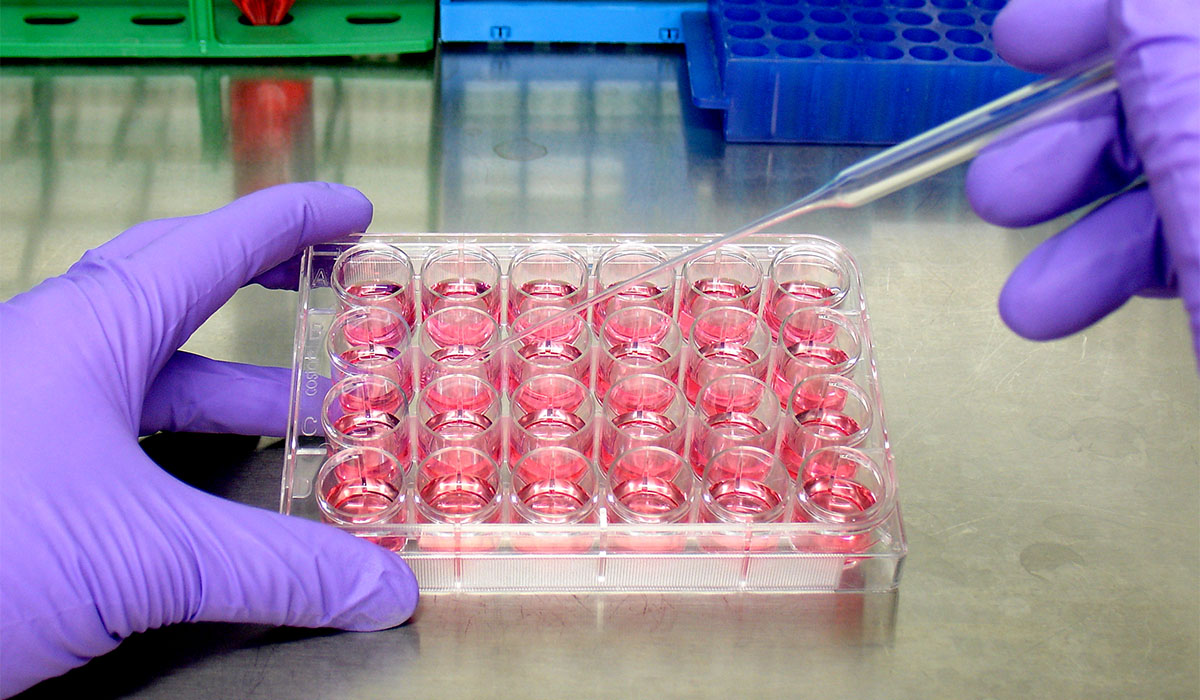Discoveries in Medicine - Success with Epigenetic Therapy to Inhibit MDSCs