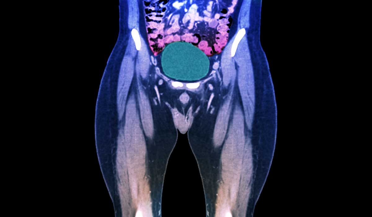 Discoveries in Medicine - Toward Smaller, MRI-compatible ...