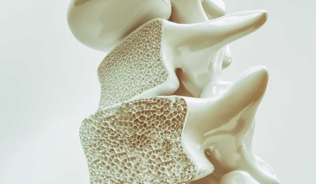 Discoveries in Medicine - Investigating the Biomineralization Paradox