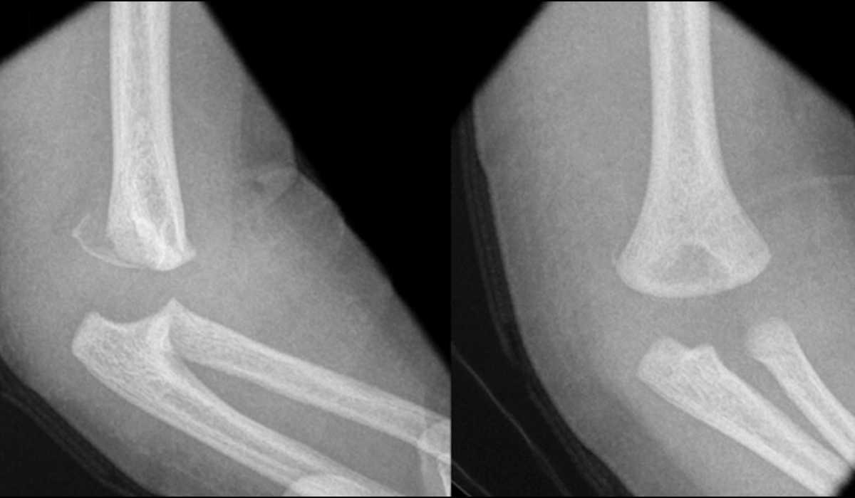 Discoveries in Medicine - Data Backs 'Non-accidental' Referral for ...