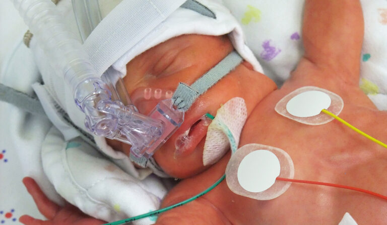 Discoveries in Medicine - Charting NICU Trends in Mechanical Ventilation