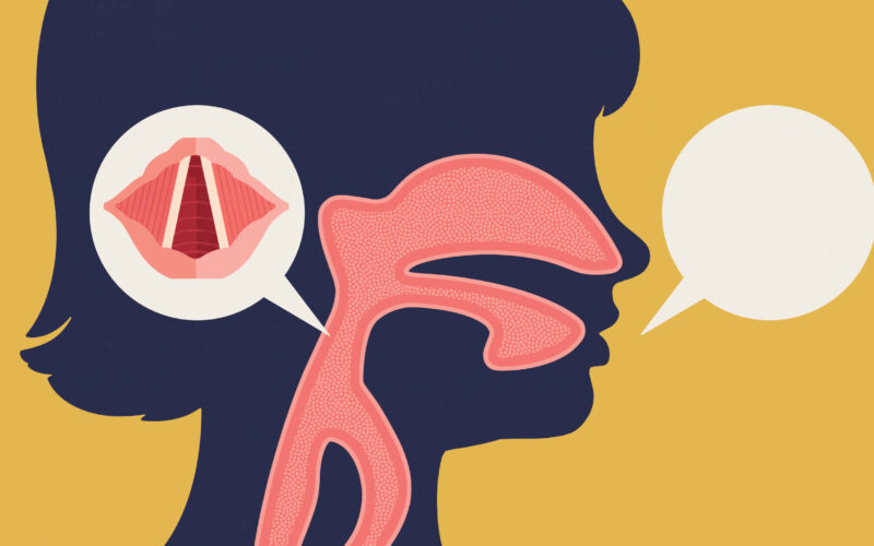 Preventing Intubation-associated Vocal Cord Injuries - Vanderbilt Discover