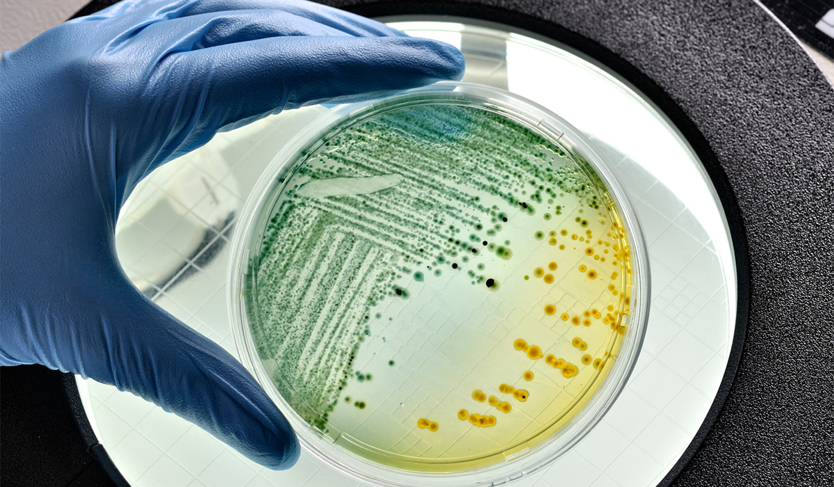 Discoveries in Medicine - On Defense Against Deadly Diarrheal Infections