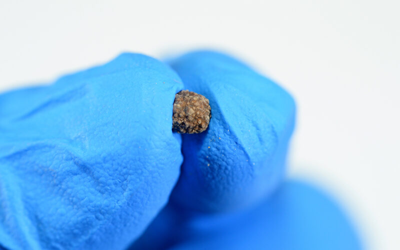 Discoveries in Medicine - Creating the First Implantable Bioartificial ...