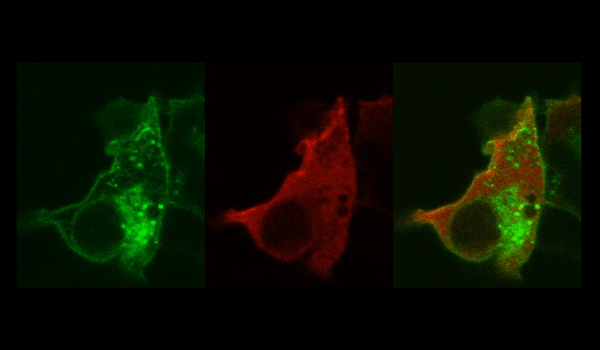Discoveries in Medicine - Scaffolding Protein Found as Key to Vascular ...