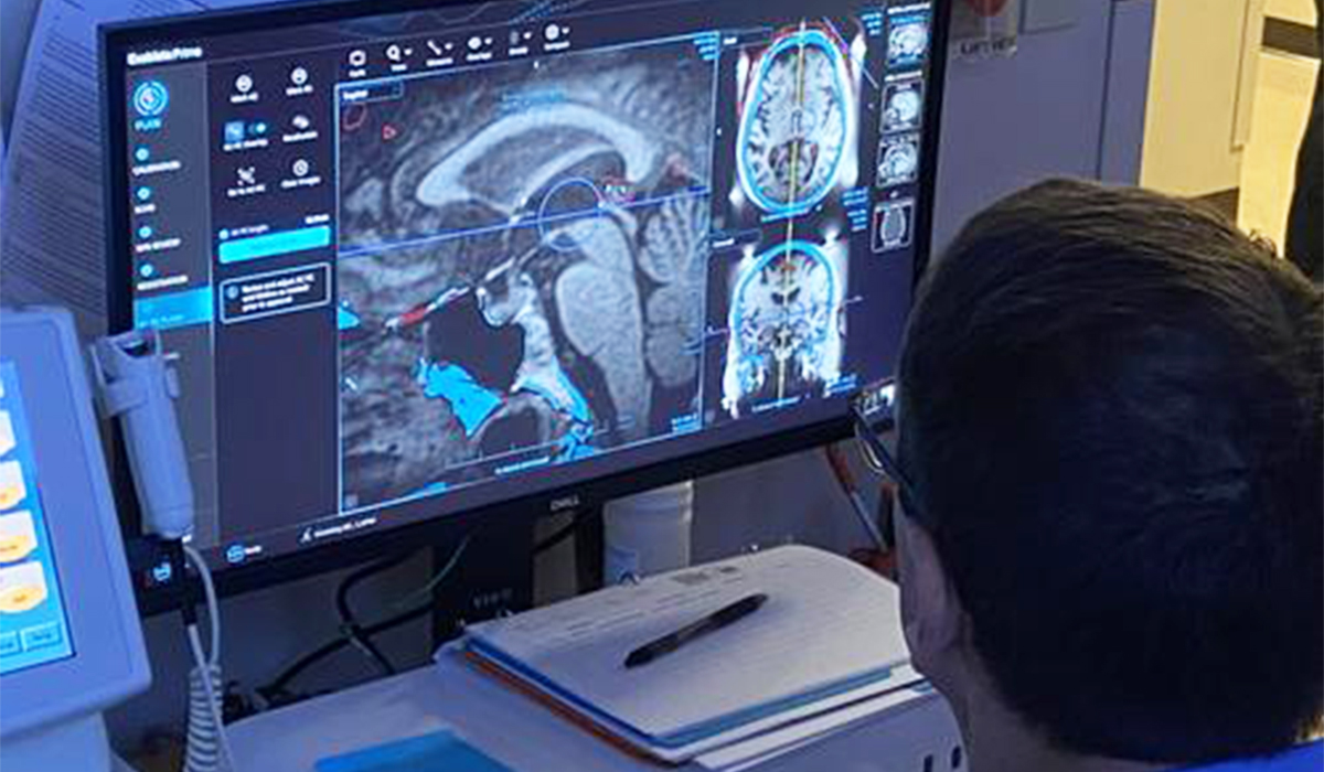 Discoveries in Medicine - 90 Minutes to Tremor Relief with Focused ...